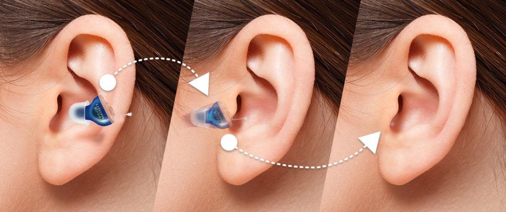 New Hearing Boosters That Combine Advanced Technology and a Competitive ...